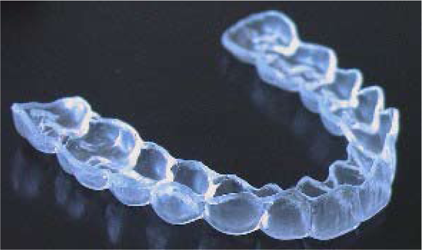 Typen der Retentionsklammern Kieferorthopädie | Zahnarztportal